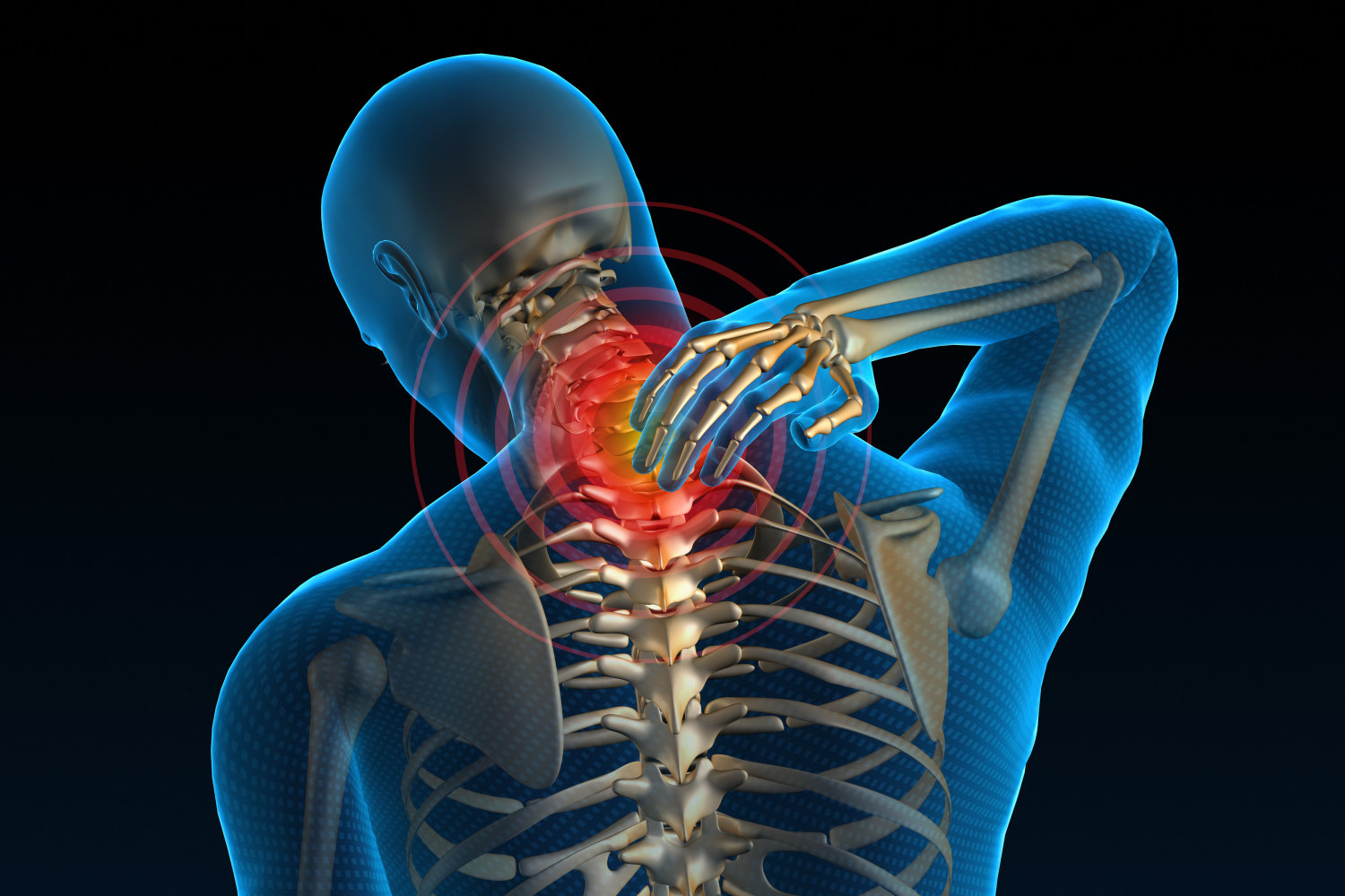 Cervical Disc Replacement - Yellowstone Sports Medicine