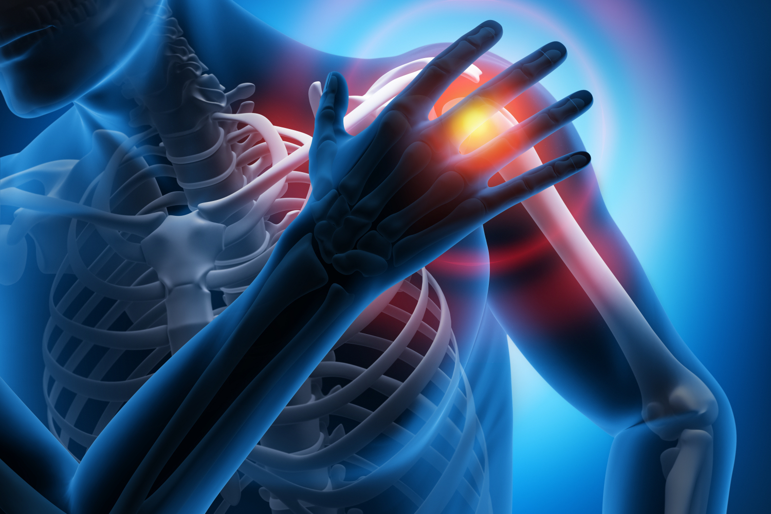 Total Shoulder Replacement - Yellowstone Sports Medicine